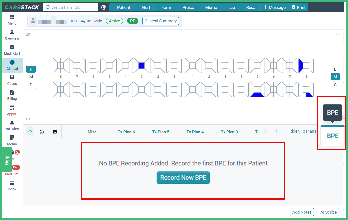 Explore the Basic Periodontal Examination Feature – CareStack