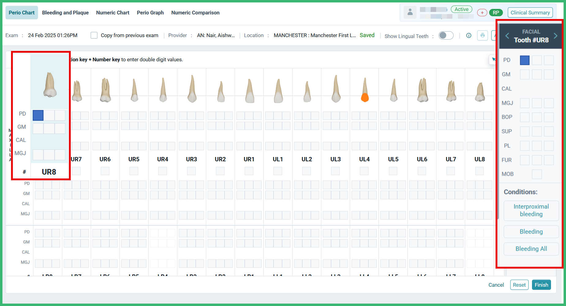 Create a Perio Chart – CareStack