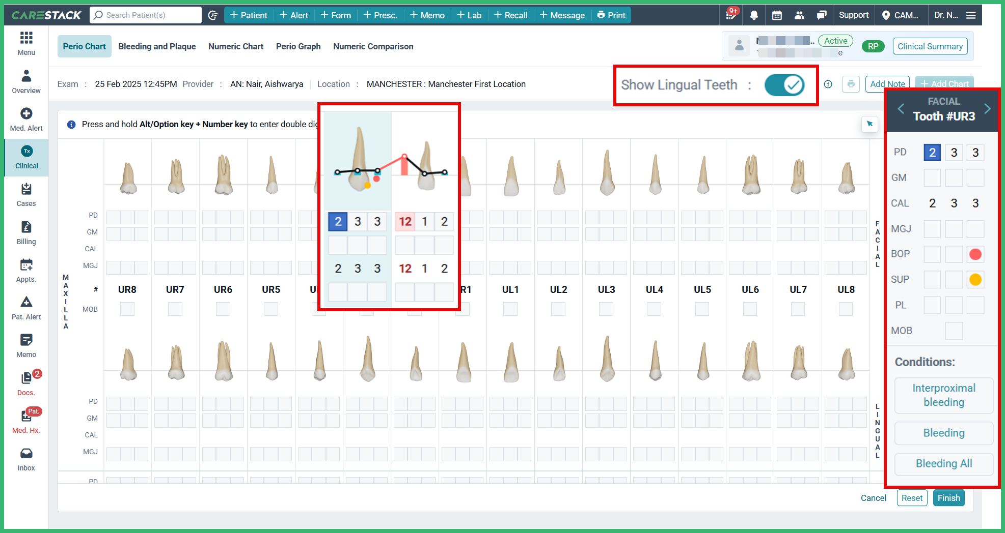 Create a Perio Chart – CareStack