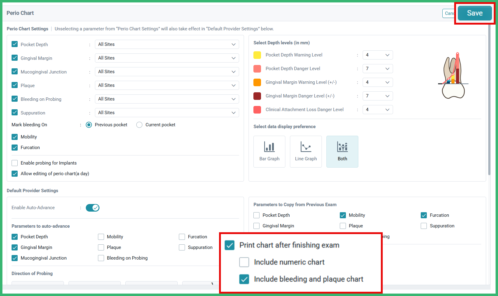 Add Plaque and Bleeding to the Perio Chart – CareStack