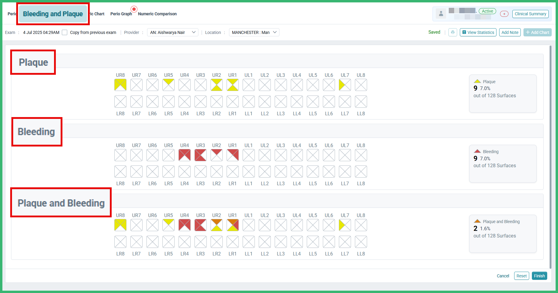 Add Plaque and Bleeding to the Perio Chart – CareStack