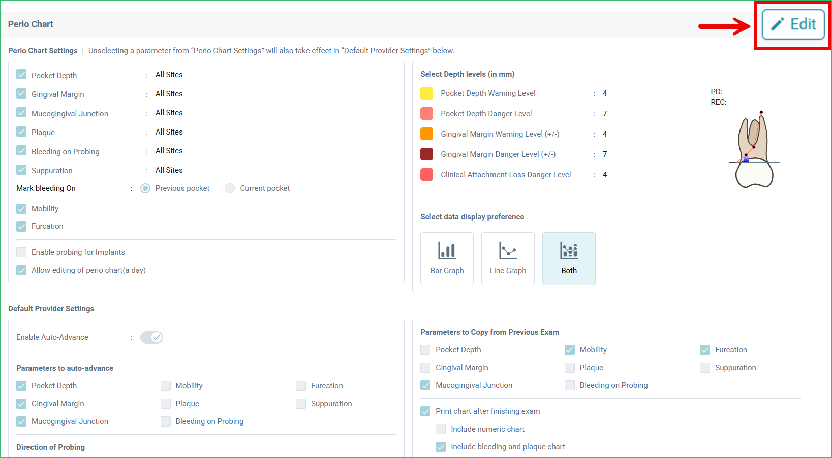 Explore the Different Options in Perio Chart & Perio Chart Settings ...
