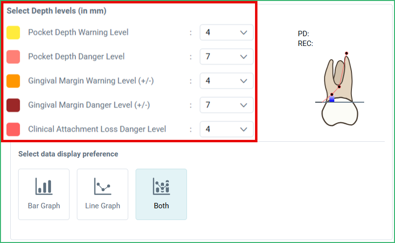 Explore the Different Options in Perio Chart & Perio Chart Settings ...